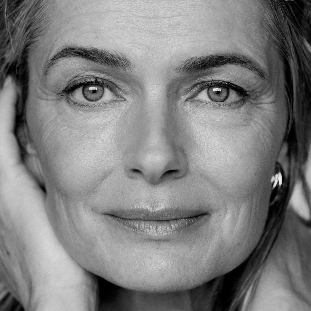 Kaj povzroča prezgodnje sivenje las in kako ga preprečiti: 6 glavnih ...